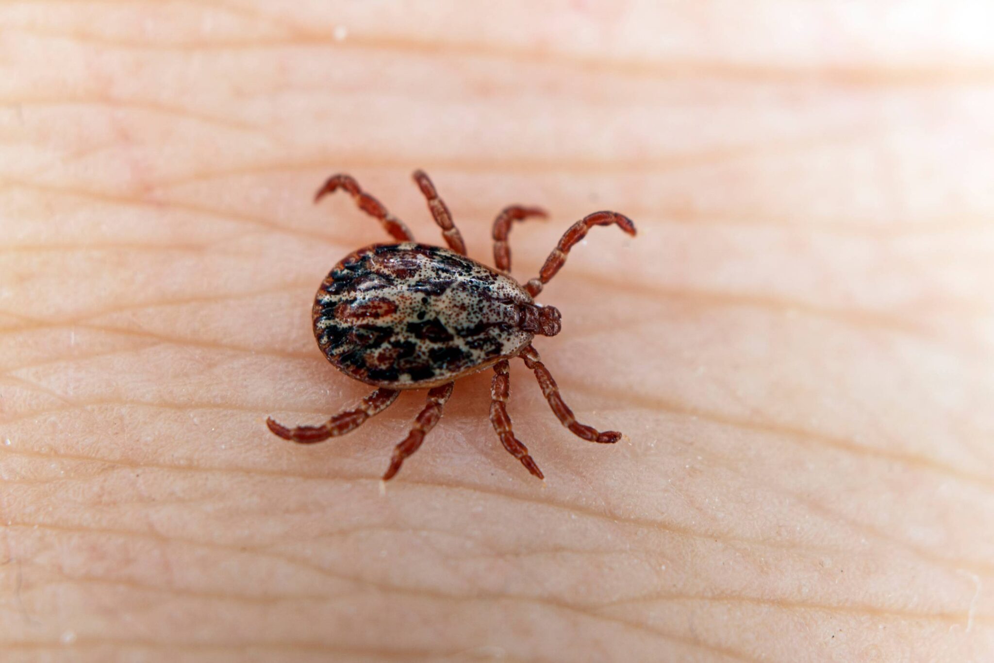 Tick-Borne Encephalitis - Hope Travel Clinic